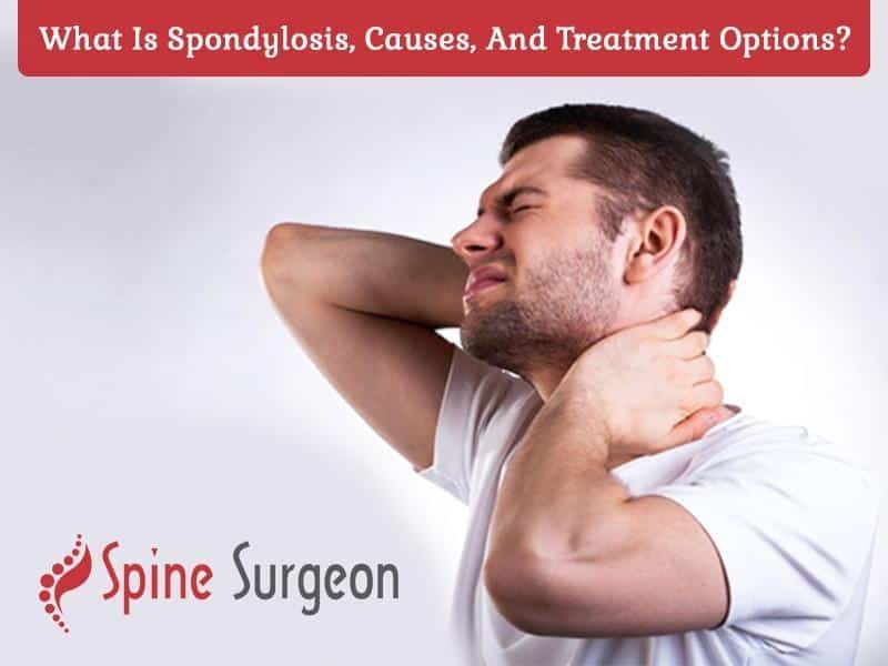 What is Spondylosis, Causes, And Treatment Options? | Spine Surgeon