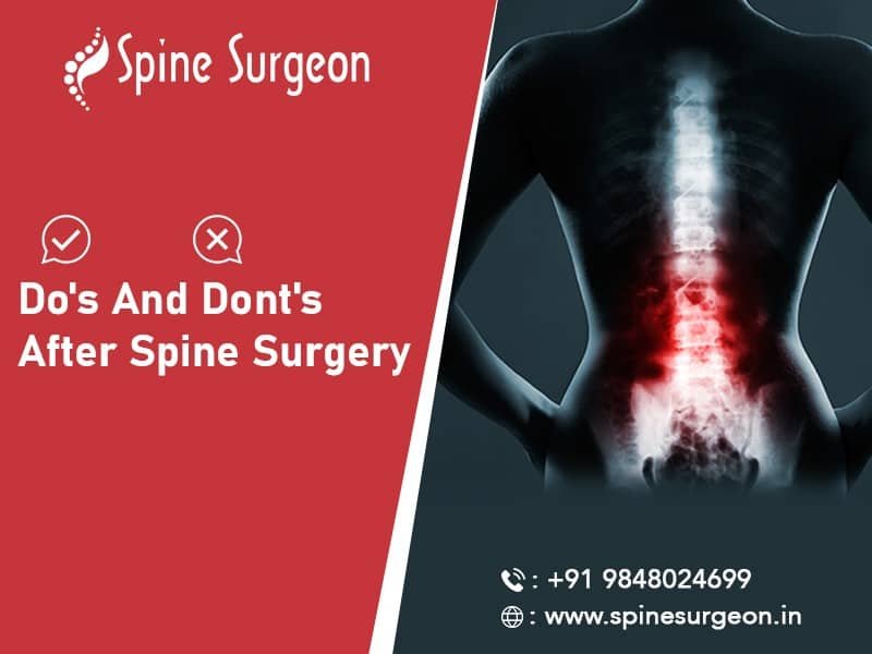 Do's and Dont's After Spine Surgery | Spine Surgeon