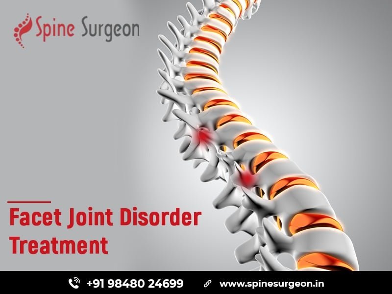 Facet Joint Disorder Treatment | Spine Surgeon