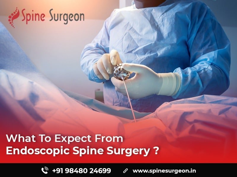 What to Expect from Endoscopic Spine Surgery? | Spine Surgeon